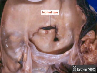 02 vascular pathology | PPT