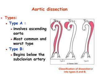 02 vascular pathology | PPT