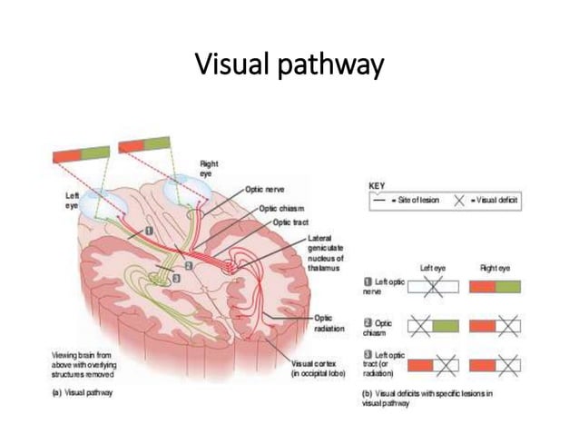 Vision.pptx | Eye and Vision Conditions | Diseases and Conditions