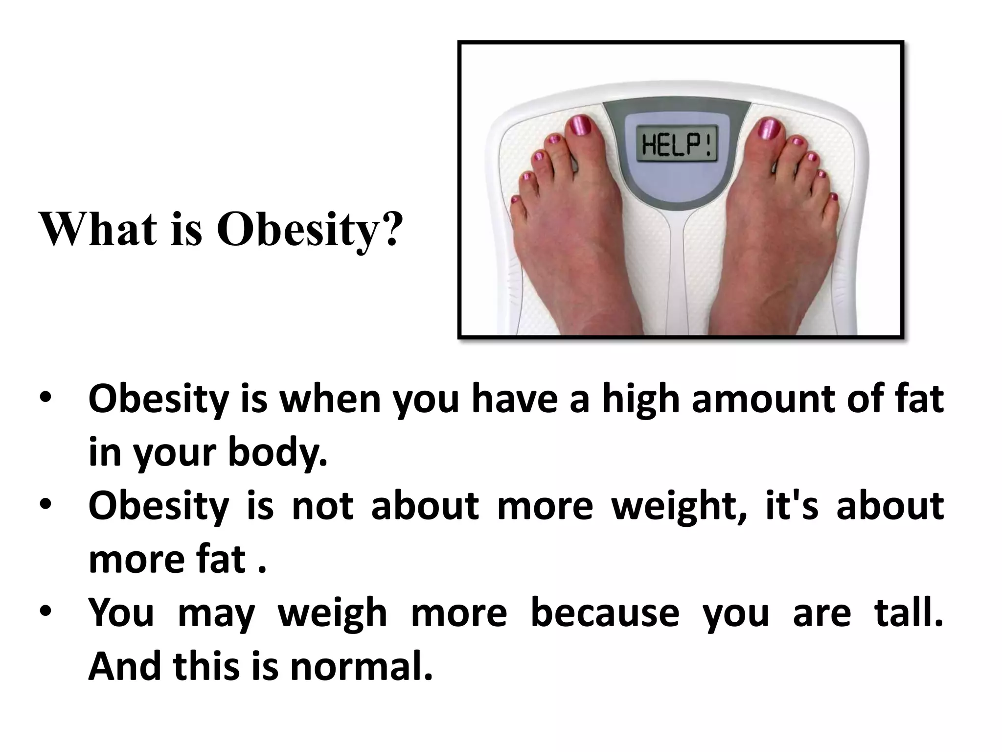 Obesity | PPT