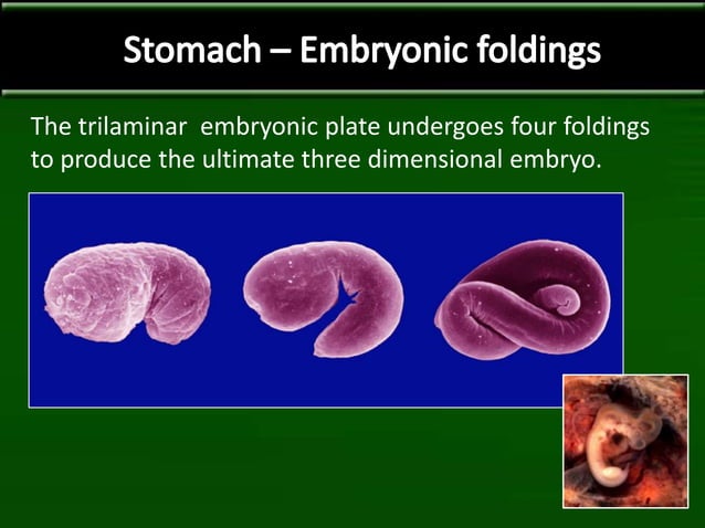 Development of stomach | PPTX