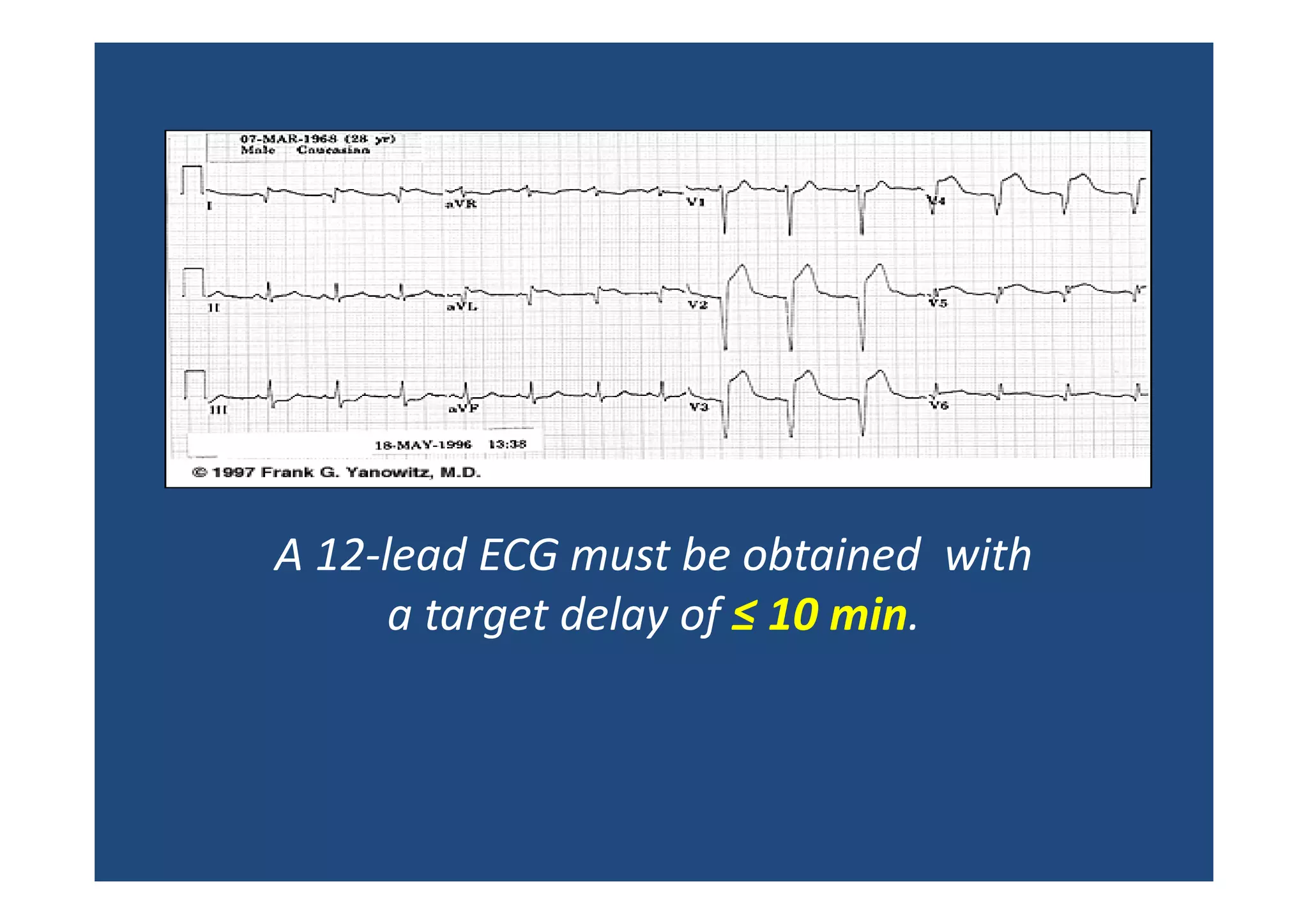 Emergency Medical System Network for STEMI Management | PPT