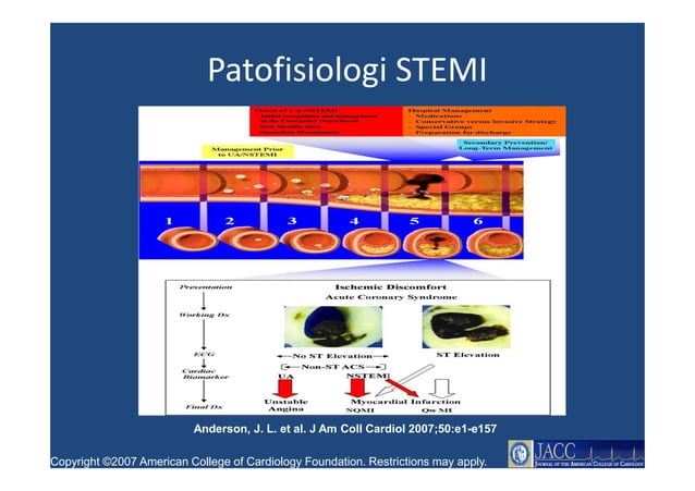 Emergency Medical System Network for STEMI Management | PPT