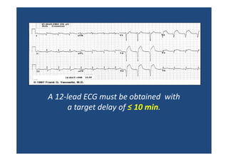 Emergency Medical System Network for STEMI Management | PDF