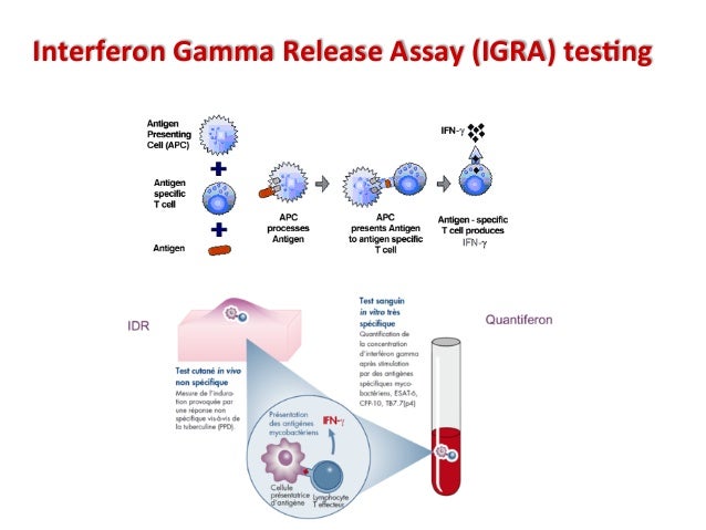 PPT Gori "Immunologia TB/HIV"