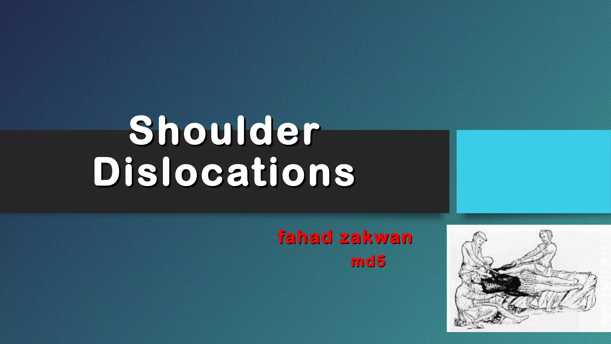 03. shoulder dislocation | PPT