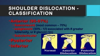 03. shoulder dislocation | PPT