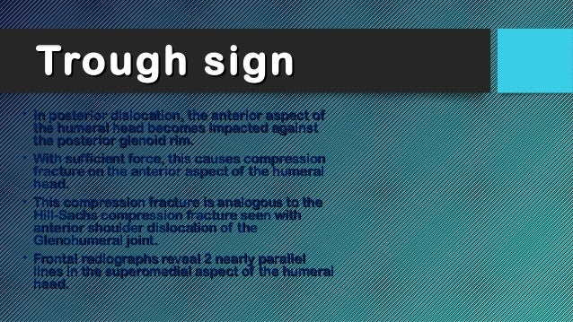 03. shoulder dislocation