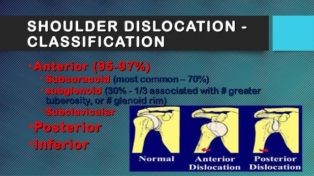 03. shoulder dislocation