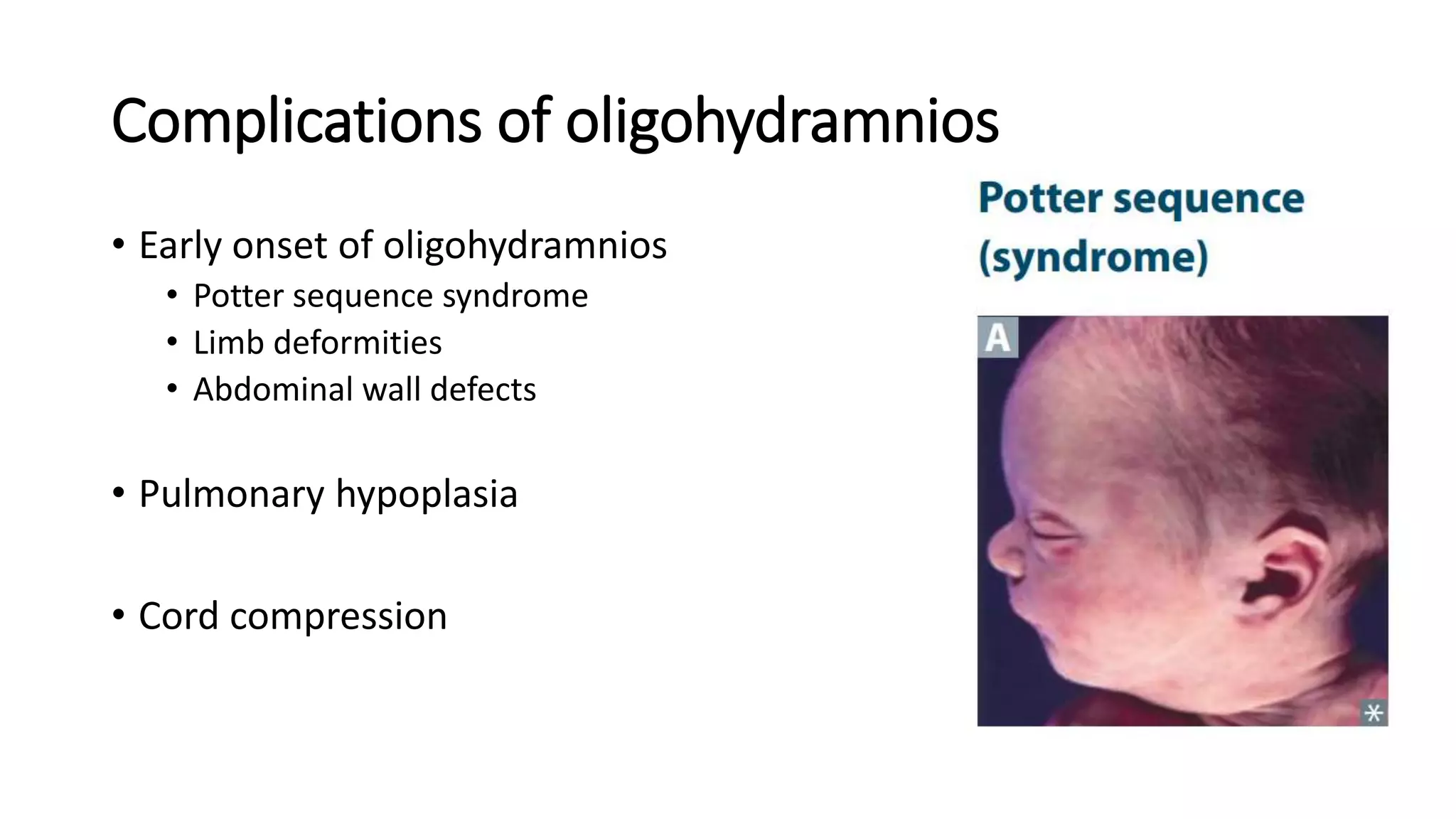 Oligohydramnios and IUGR | PPTX