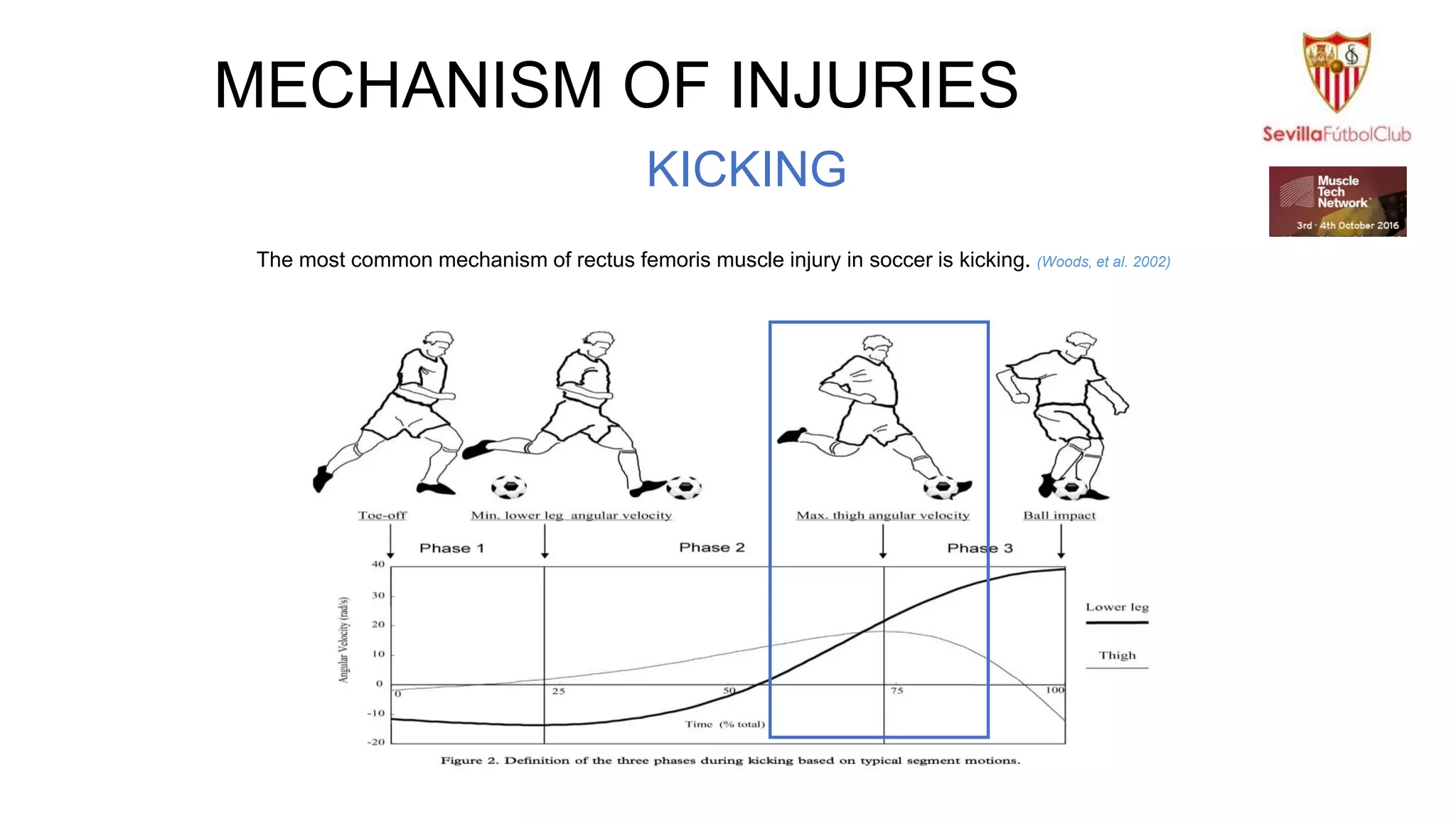 Rectus Femoris Injuries. Experience at Sevilla FC | PDF