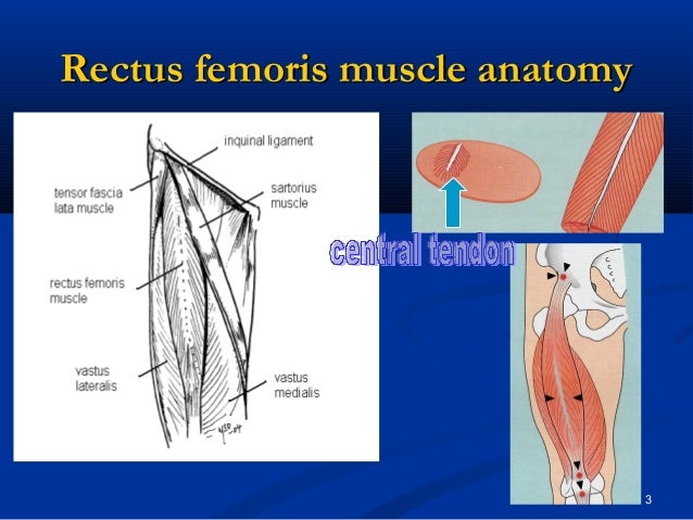 Rectus Femoris Injuries: what and when? Sakari Orava
