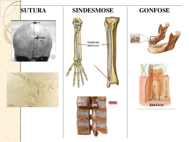 alavanca e sistemas osteo