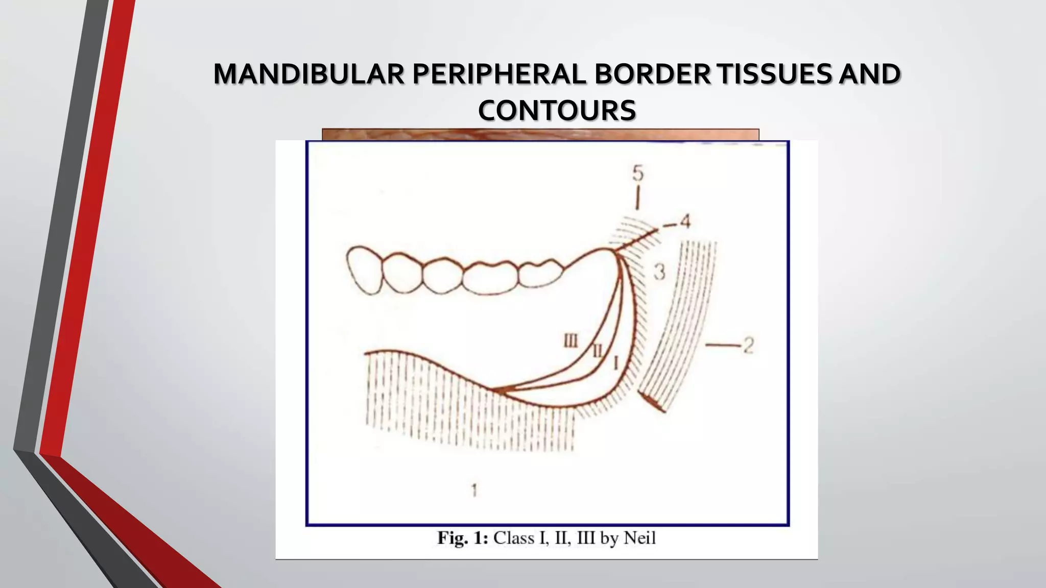 03. denture bearing area and impression techniques | PPTX