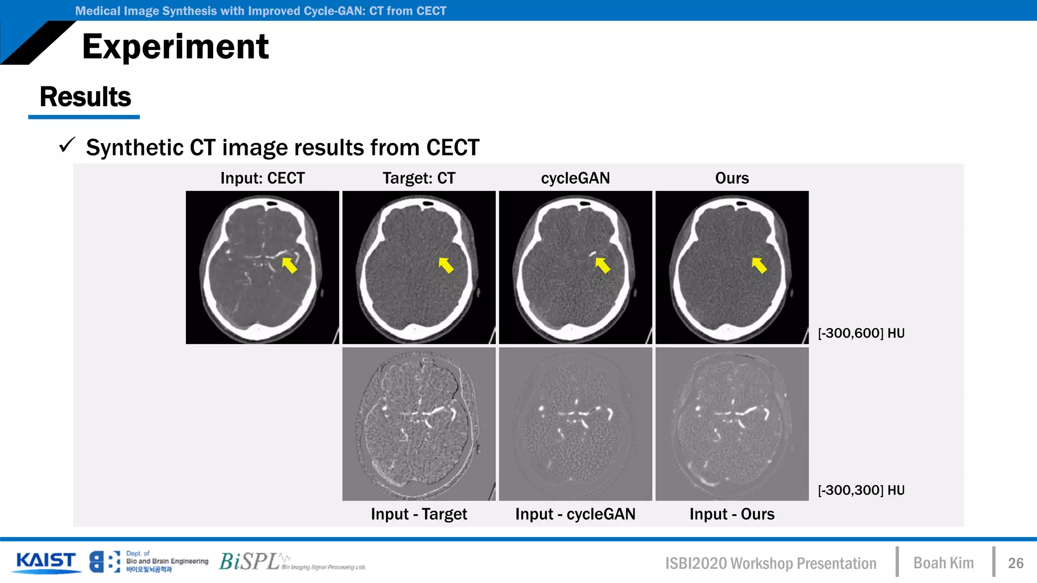 Medical Image Synthesis with Improved Cycle-GAN: CT from CECT | PDF