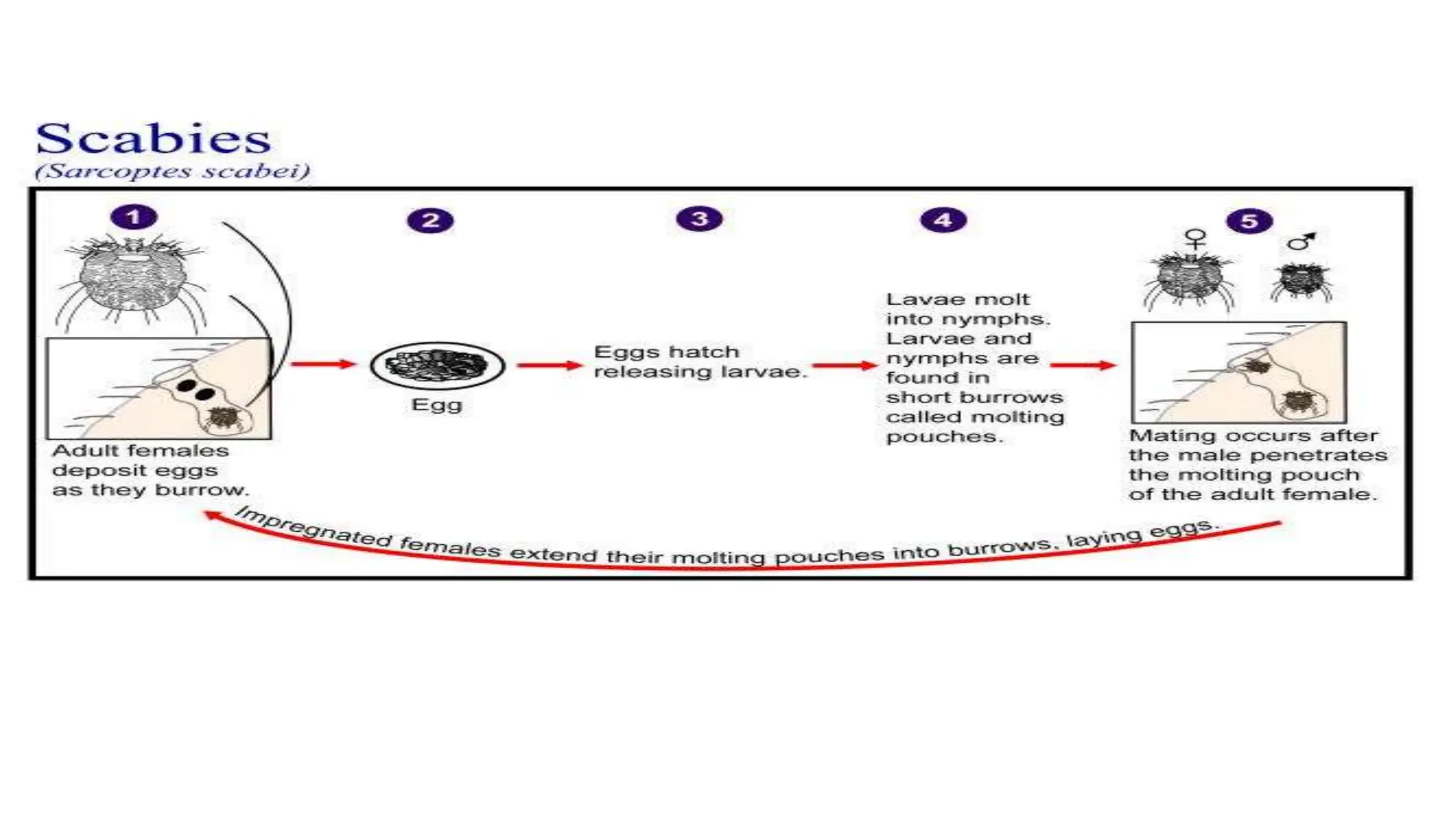 Scabies etiology, transmission, risk factors, clinical variants, clinical features, diagnosis ...