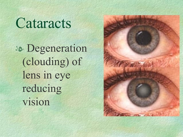 Eye health and vision standards for lifeguards | PPS | Eye and Vision ...