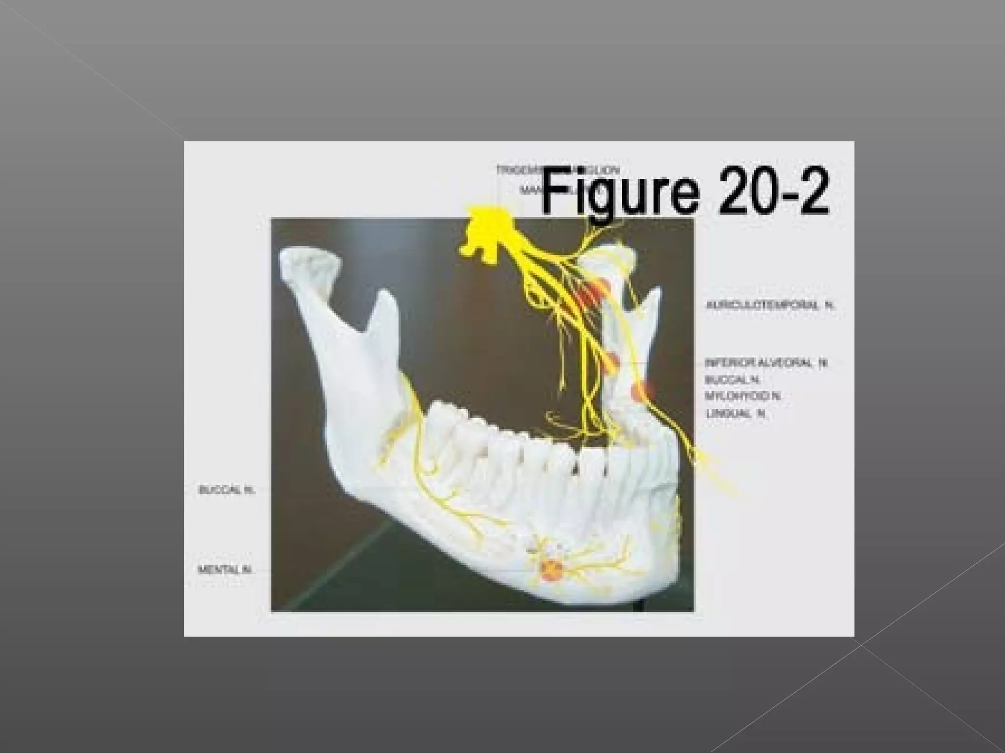 03 anaesthetic considerations in maxillofacial trauma surgery | PPT