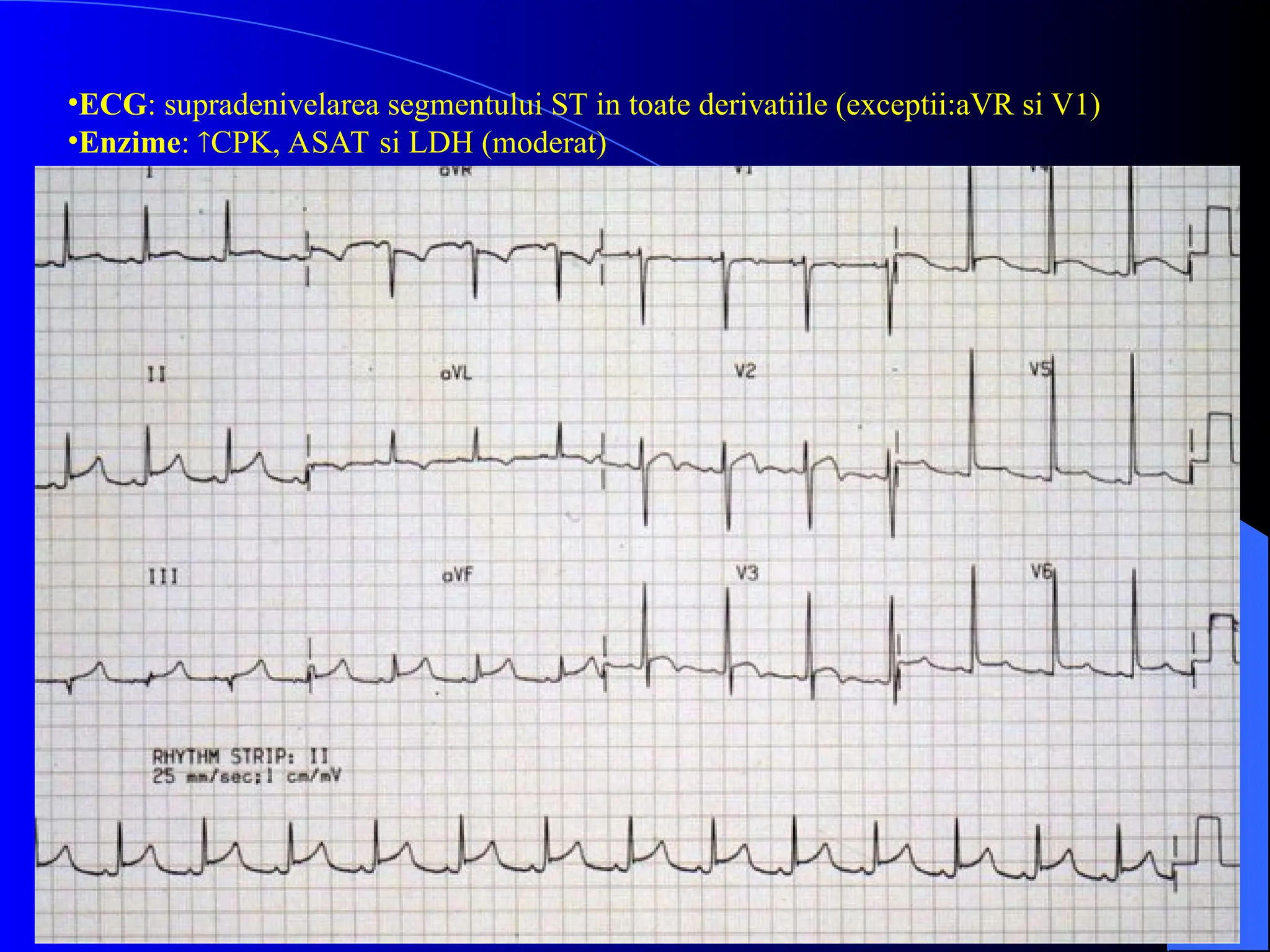 03 - cv - curs 6 - cm-pericardite.ppt.ppt