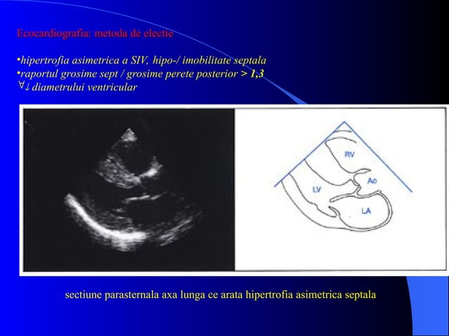 03 - cv - curs 6 - cm-pericardite.ppt.ppt
