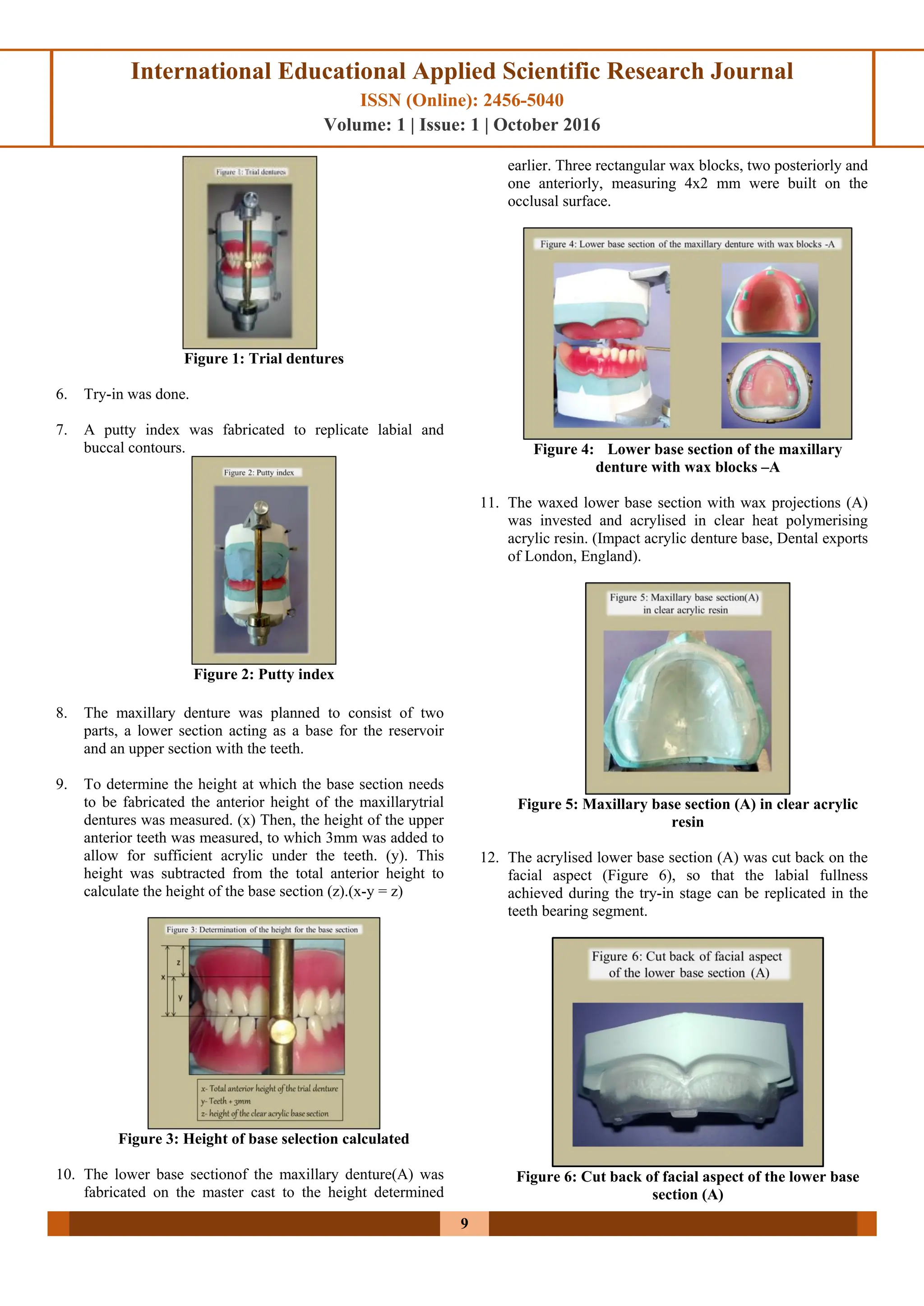 FABRICATION OF A MAXILLARY SPLIT COMPLETE DENTURE FOR A POST-MENOPAUSAL ...