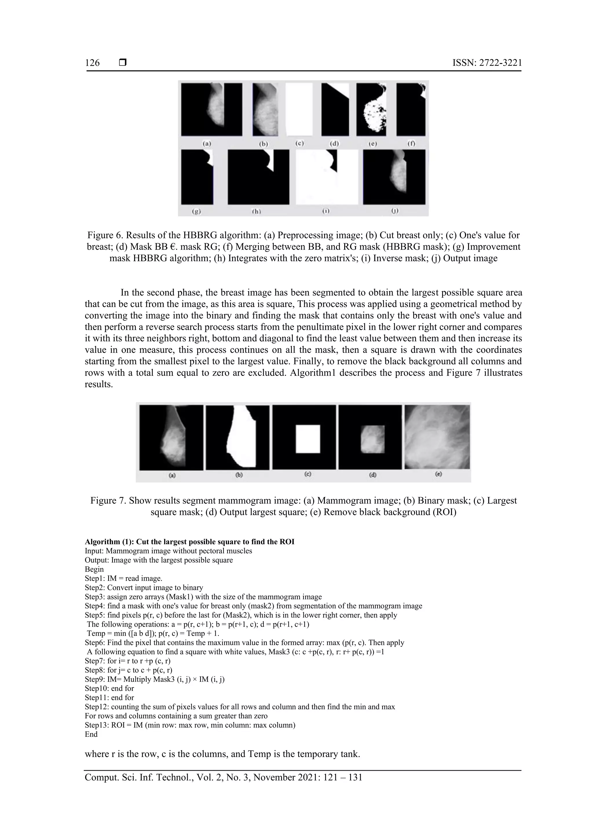 Classification Of Mammograms Based On Features Extraction Techniques Using Support Vector