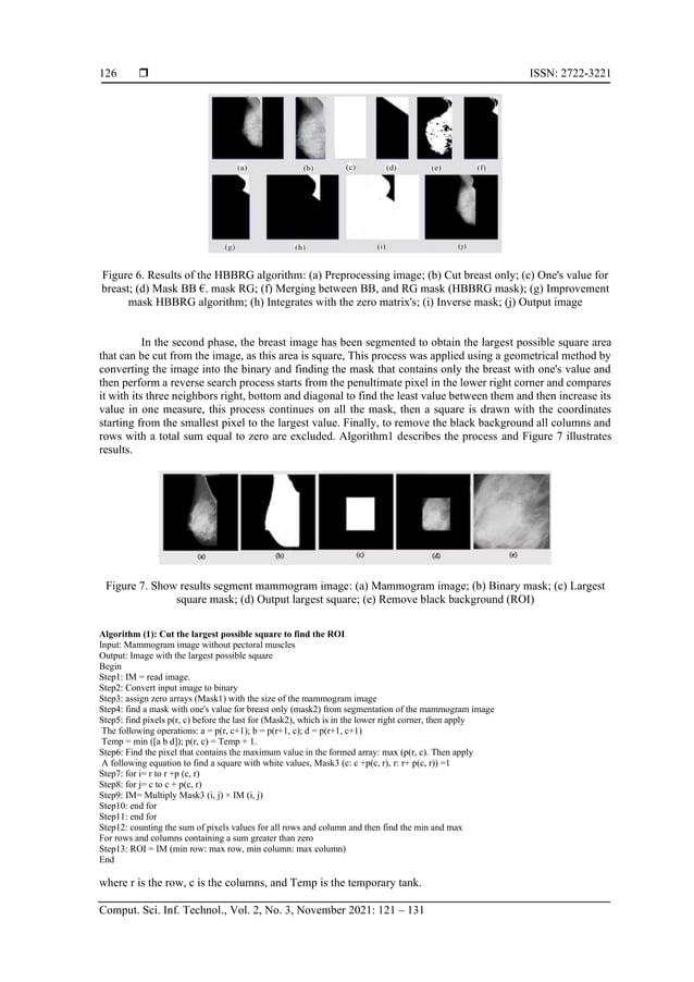 Classification of mammograms based on features extraction techniques using support vector ...