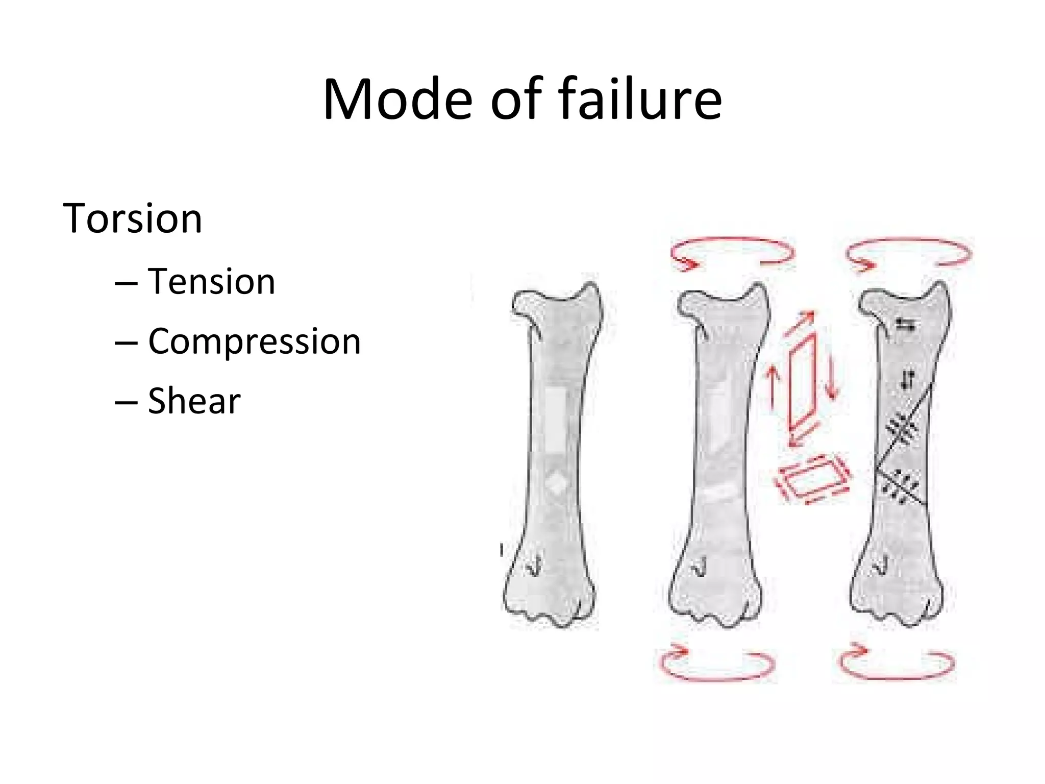ortho 03 principle of closed reduction in fracture and dislocation | PPT