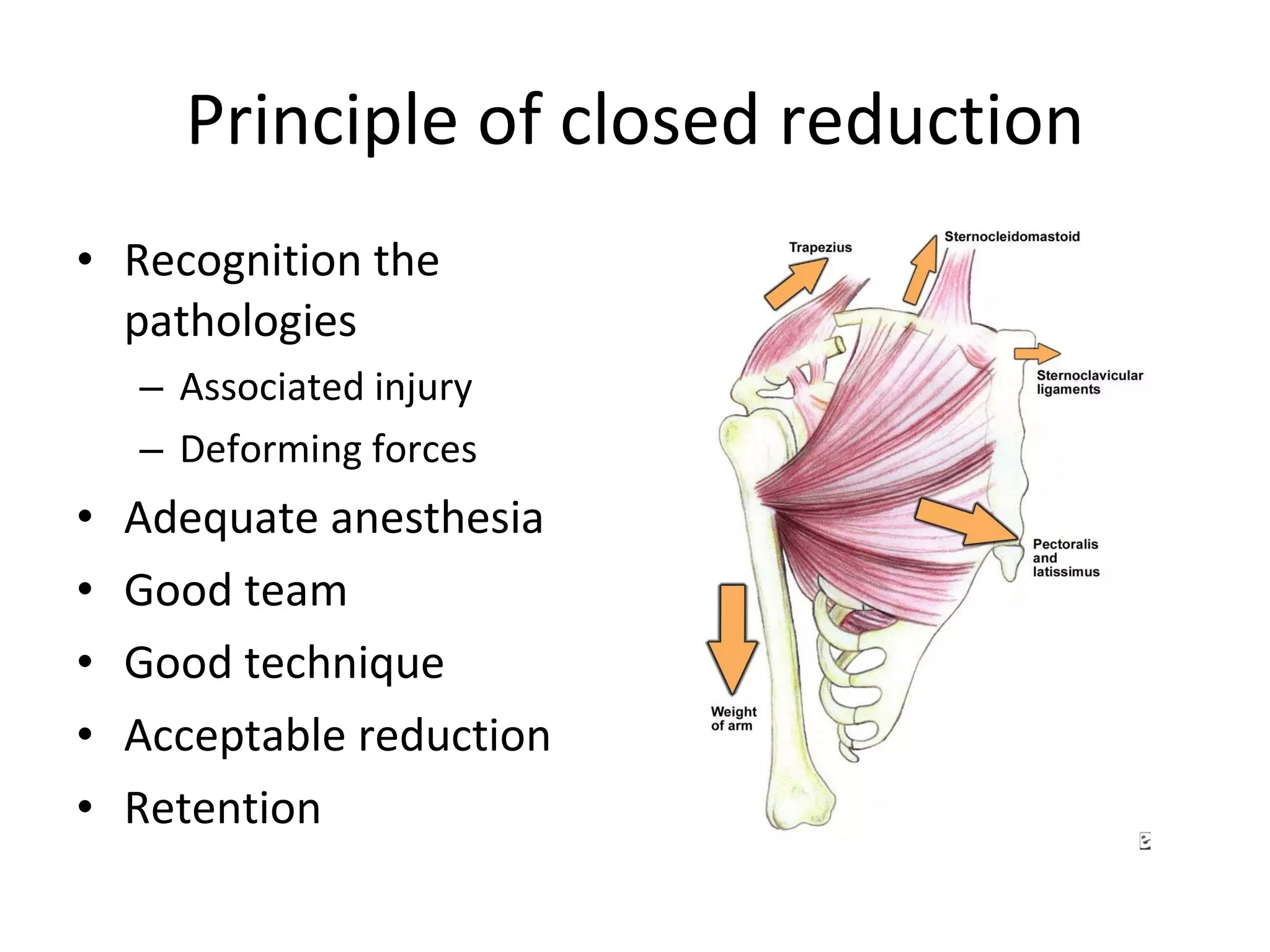 ortho 03 principle of closed reduction in fracture and dislocation | PPT