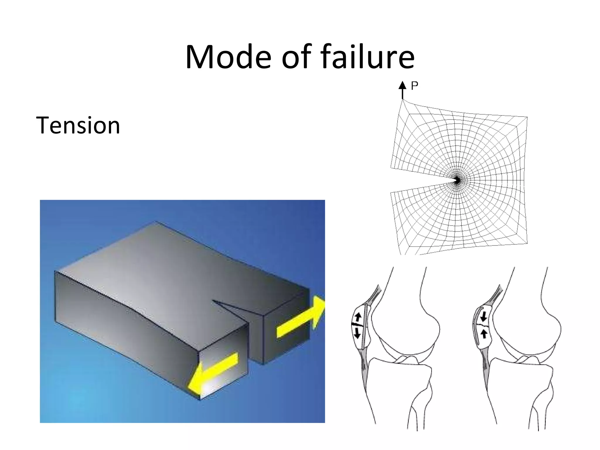 ortho 03 principle of closed reduction in fracture and dislocation | PPT