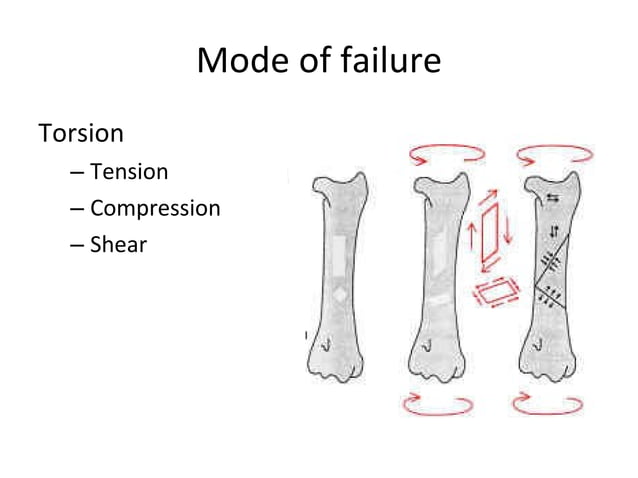 ortho 03 principle of closed reduction in fracture and dislocation | PPT