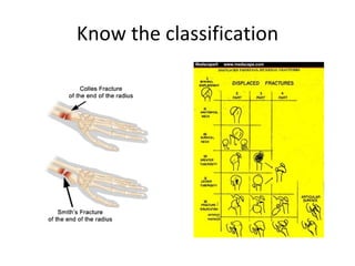 ortho 03 principle of closed reduction in fracture and dislocation | PPT
