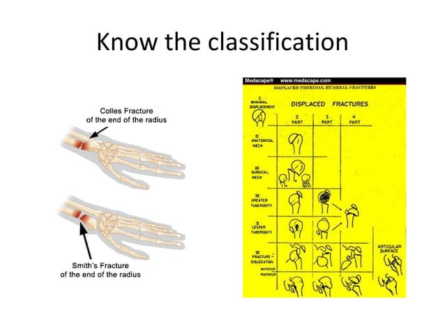 ortho 03 principle of closed reduction in fracture and dislocation | PPT