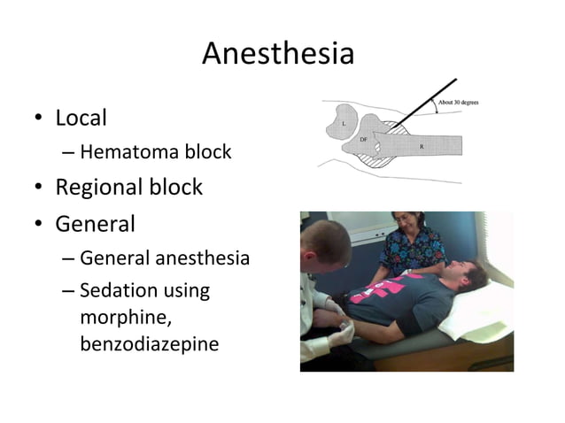 ortho 03 principle of closed reduction in fracture and dislocation | PPT