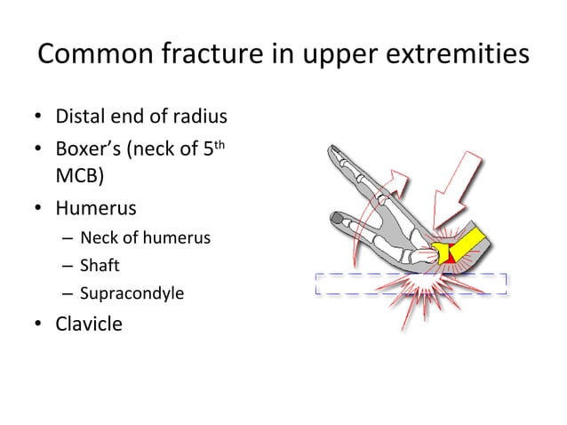 ortho 03 principle of closed reduction in fracture and dislocation | PPT