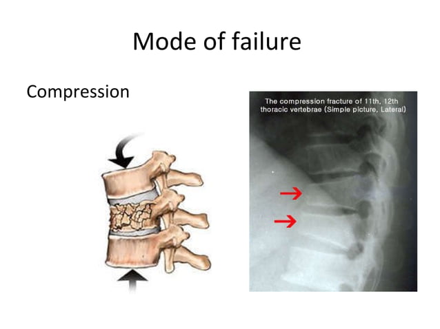 ortho 03 principle of closed reduction in fracture and dislocation | PPT
