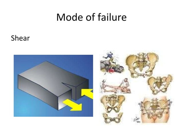 ortho 03 principle of closed reduction in fracture and dislocation | PPT