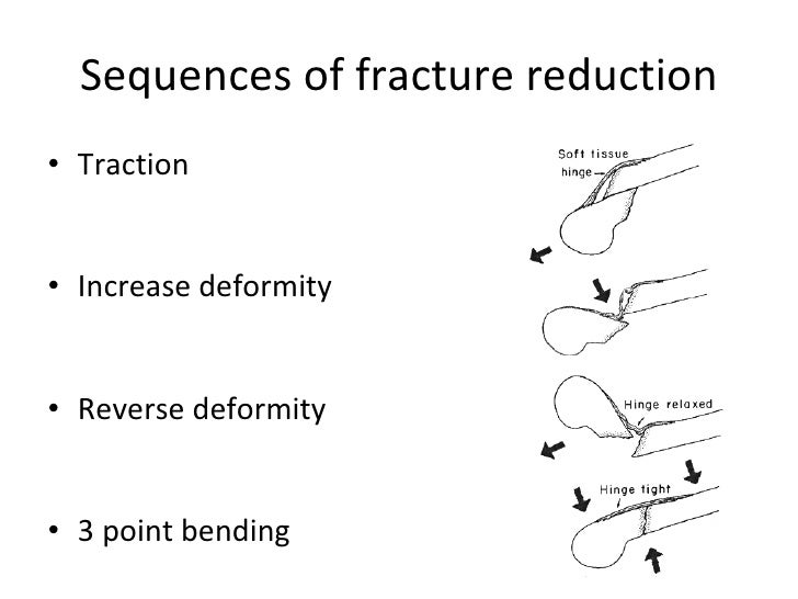 ortho 03 principle of closed reduction in fracture and dislocation