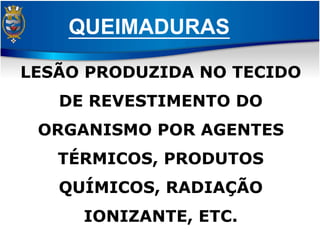 primeiros socorros em caso de queimaduras | PPT