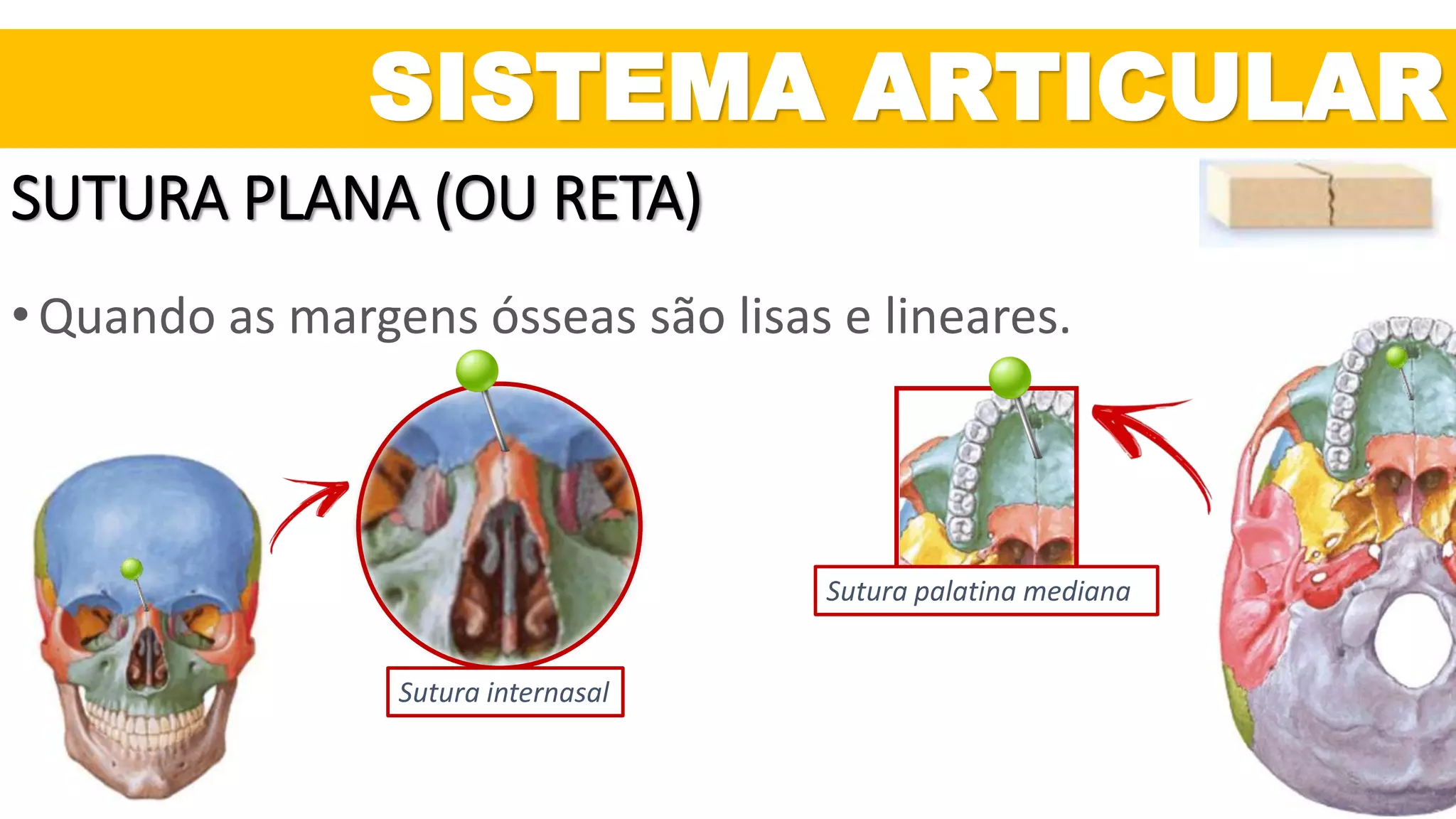03 sistema articular | PPT