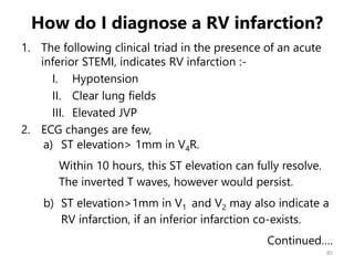 st elevation myocardial infarction (stemi) | PPTX
