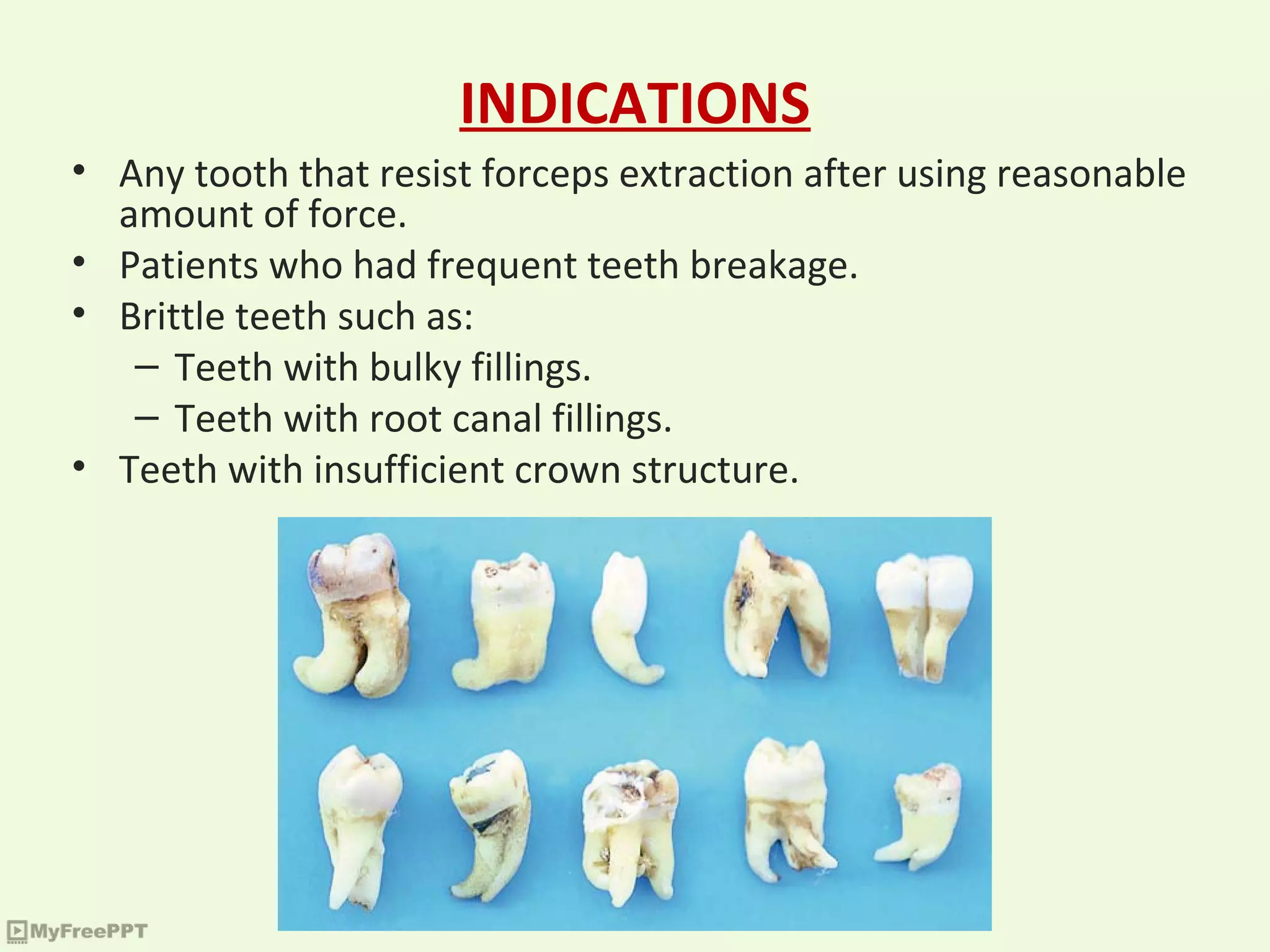 Surgical removal of teeth and roots | PPT