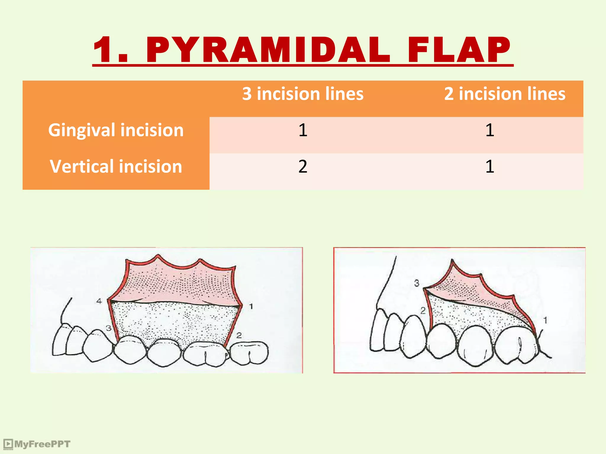 Surgical removal of teeth and roots | PPT