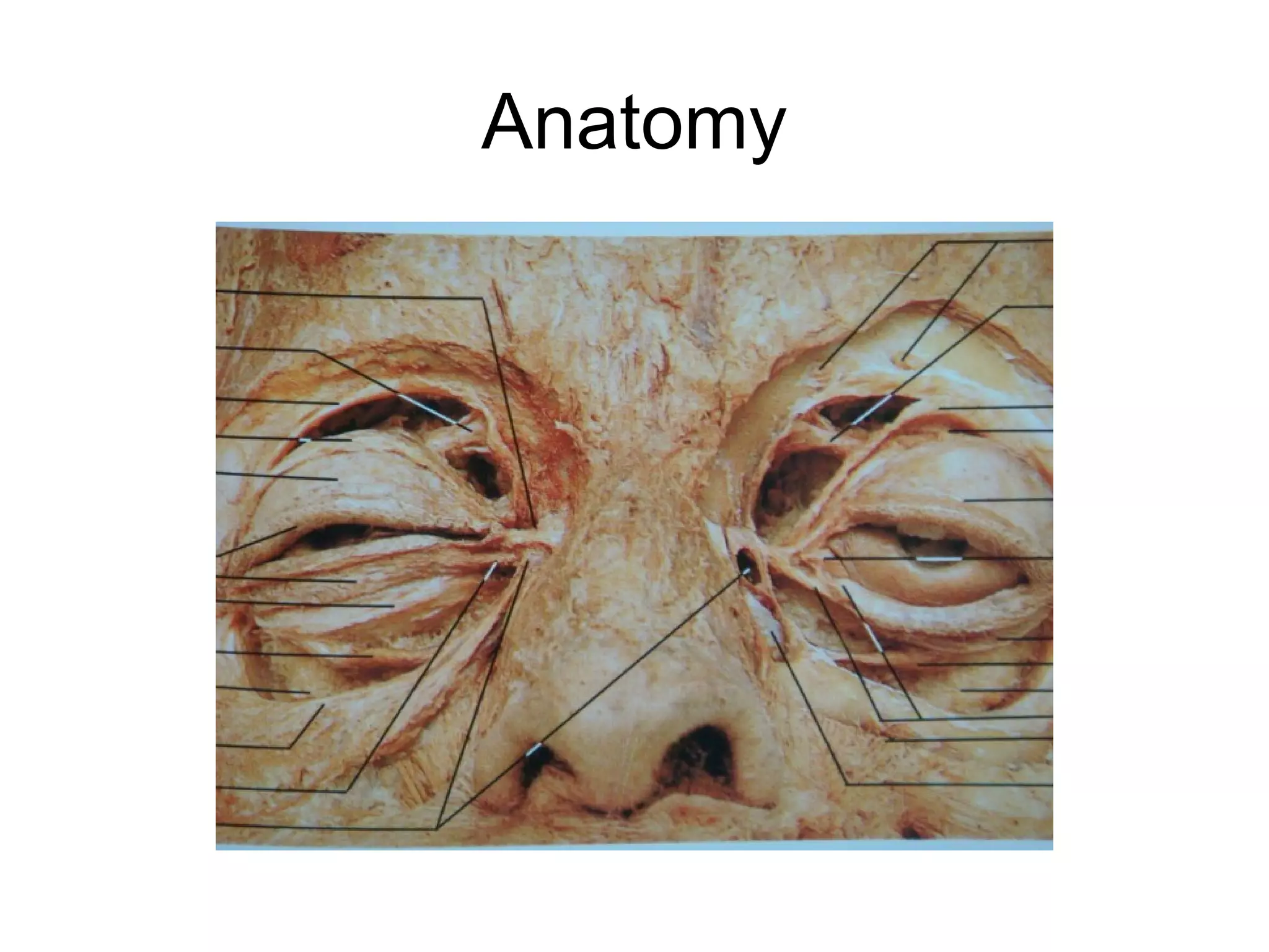 03 traumatic telecanthus | PPT