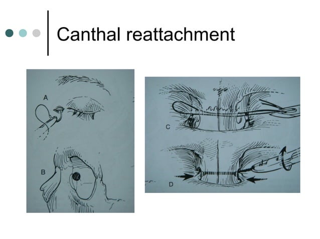 03 traumatic telecanthus | PPT | Death, Injury, or Military Conflict ...