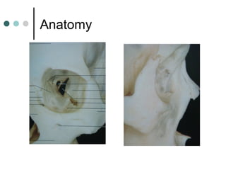 03 traumatic telecanthus | PPT