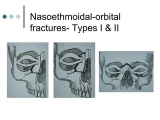 03 traumatic telecanthus | PPT | Death, Injury, or Military Conflict ...