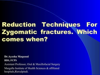zygomatic reduction,which comes when | PPT
