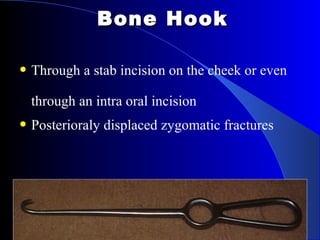 zygomatic reduction,which comes when | PPT