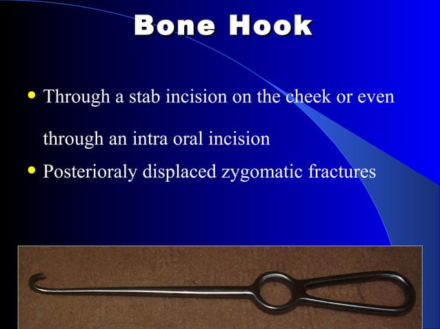 zygomatic reduction,which comes when | PPT
